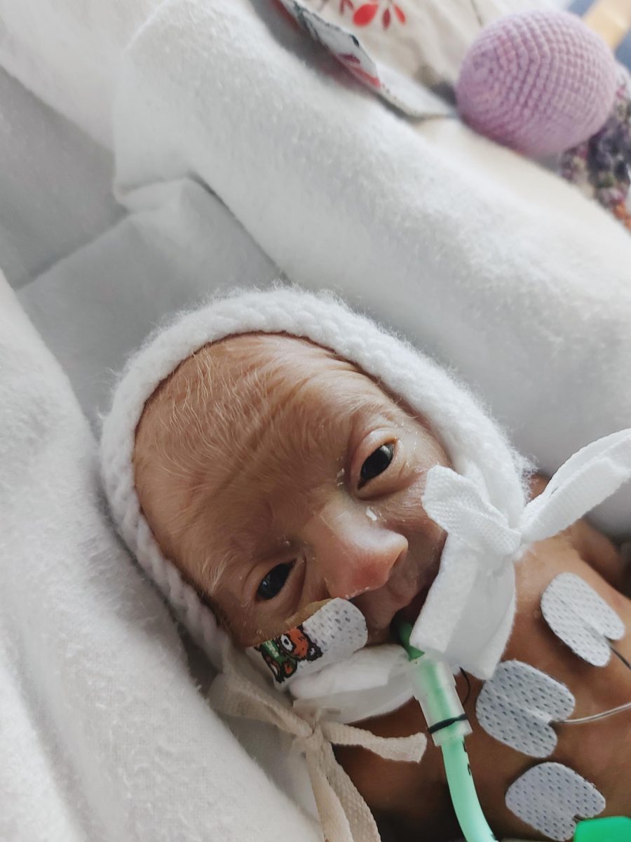 ‘My miracle, my inspiration, my hero’: Amaya Rae’s story - Ronald ...