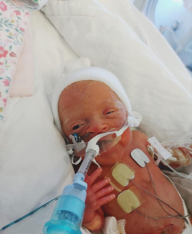 ‘My miracle, my inspiration, my hero’: Amaya Rae’s story - Ronald ...