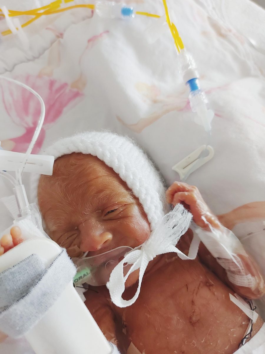 ‘My miracle, my inspiration, my hero’: Amaya Rae’s story - Ronald ...