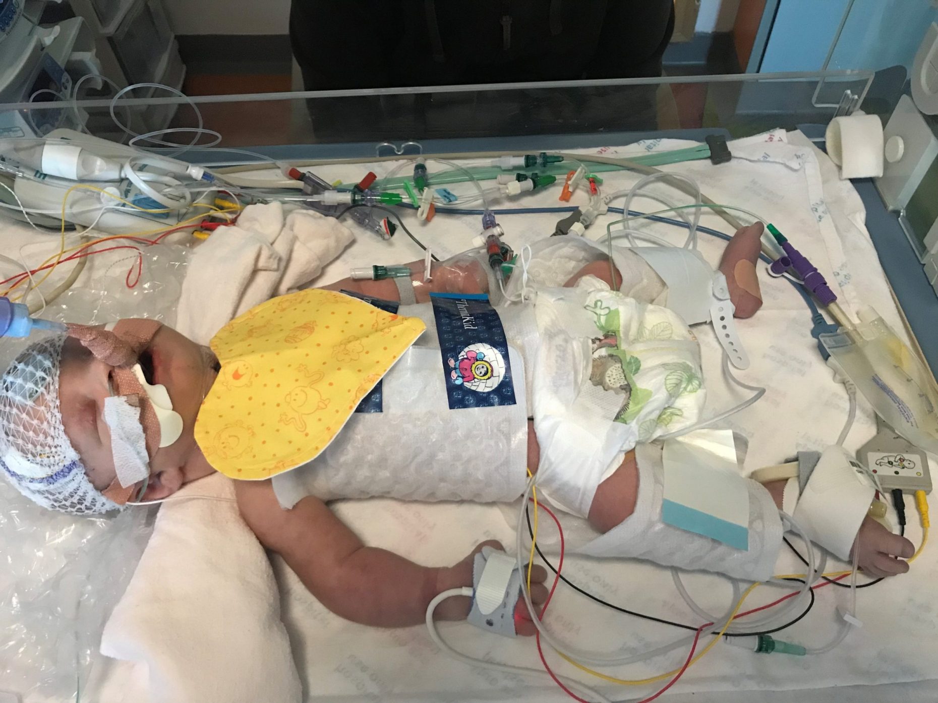 The House was our 'constant': Louisa's story - Ronald McDonald House ...